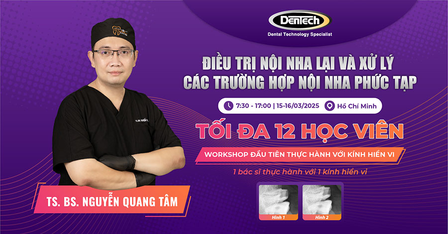 Điều trị nội nha lại và xử lý các trường hợp nội nha phức tạp - Dentech Việt Nam